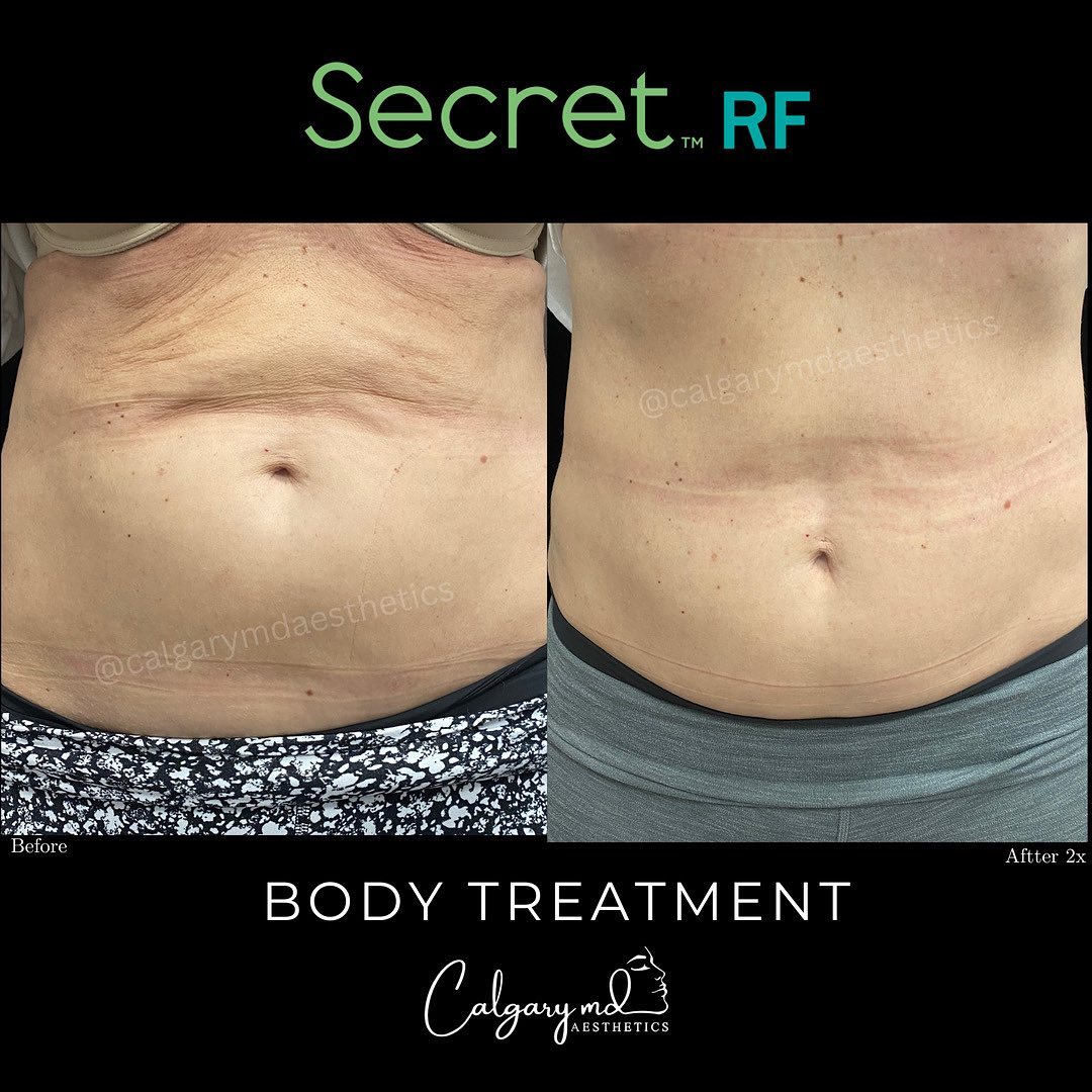 Calgary Neuromodulators, Filler, truSculptiD, Secret RF and much more